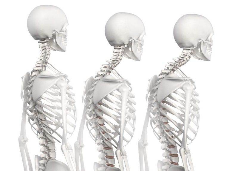 Bodi Empowerment - Dr Ken Nakamura Downtown Toronto Chiropractor : Dr ...