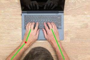 5 Way To Help Carpal Tunnel Syndrome